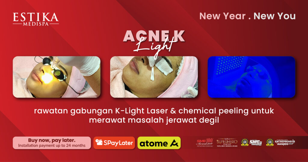Acne K Light – No.1 Best Advanced Solution for Clear Skin