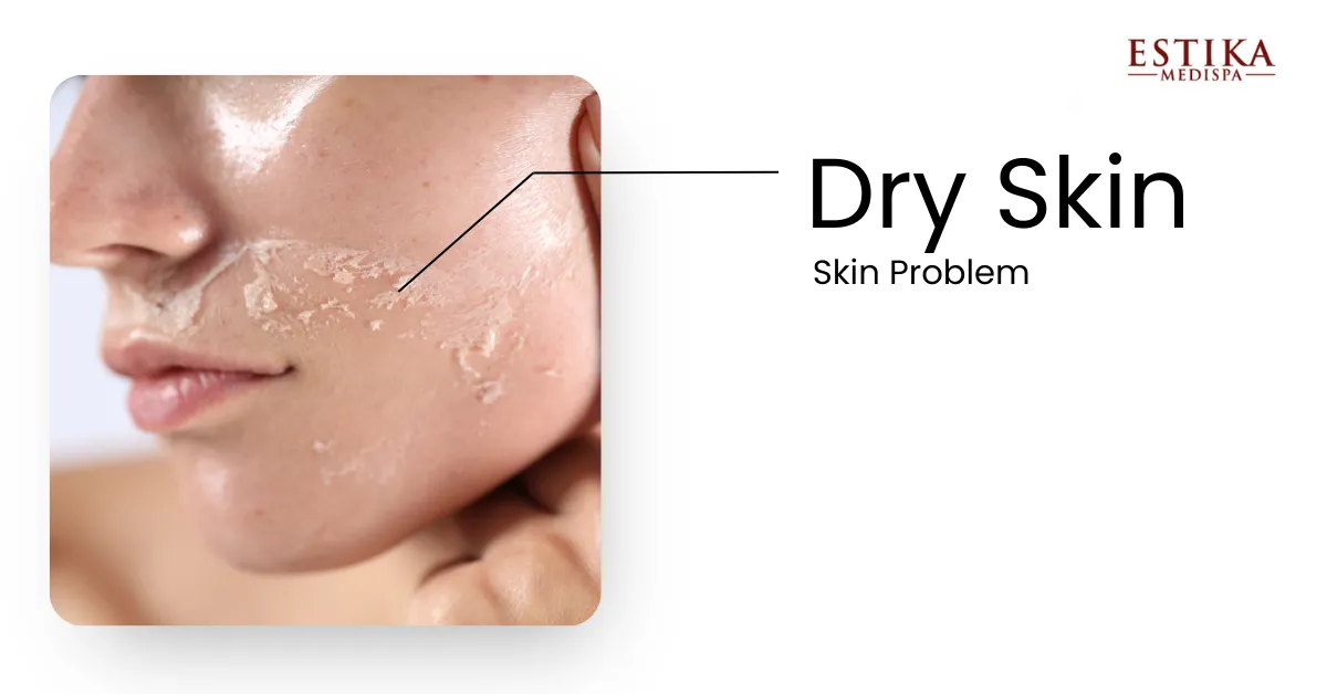 Dry Skin Guide : Problems, Symptoms & Clinical Solutions